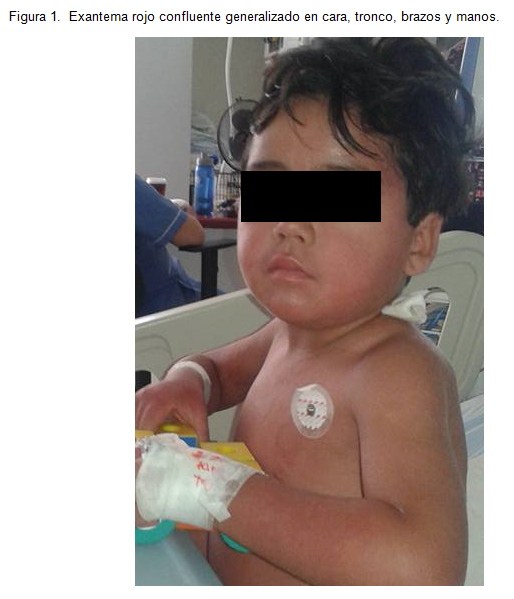 Revista Pediatría Electrónica